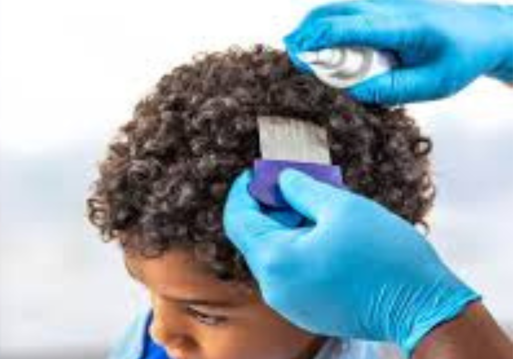 Lice Removal Kit: Order One of These Top 6 Kits ASAP Now!